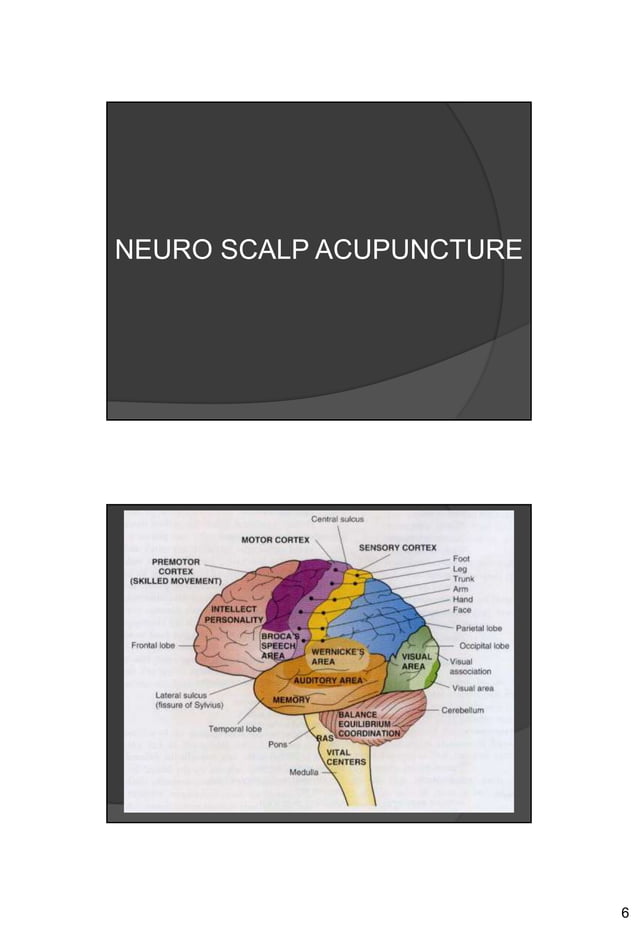 Neuro acupuncture | PDF