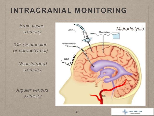 Neuroanaesthesia update | PPTX