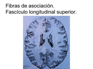 Fascículo Longitudinal Superior