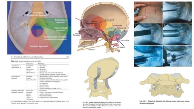 Neuroanatomía de Unión Craneocervical - Dr Ricardo Cázares Mejía | PPTX