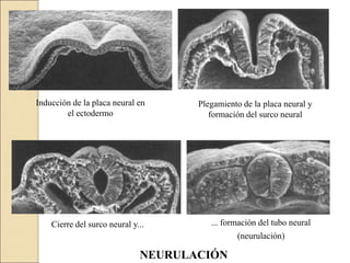 Placa Neural De Sapo