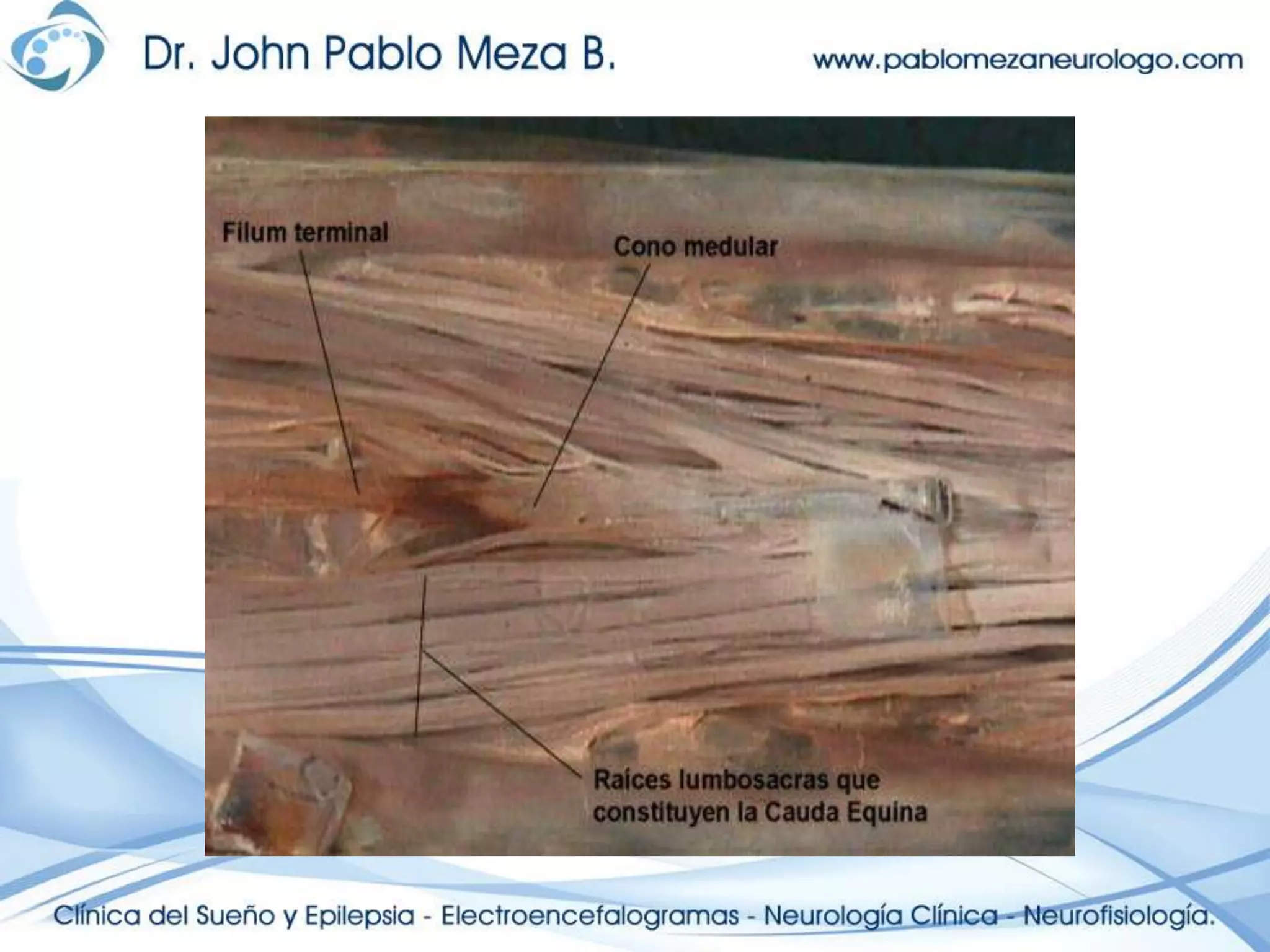 Neuroanatomia anatomia de la médula espinal | PPTX