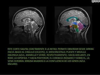 Neuroanatomia rm | PPTX