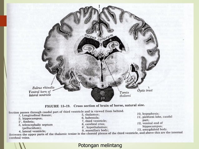 Neuroanatomi ub.pdf