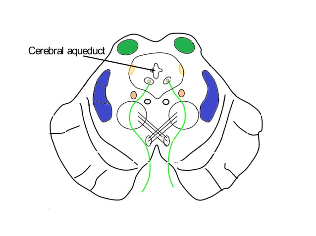 Midbrain And Cerebellum | PPT | Death, Injury, or Military Conflict ...