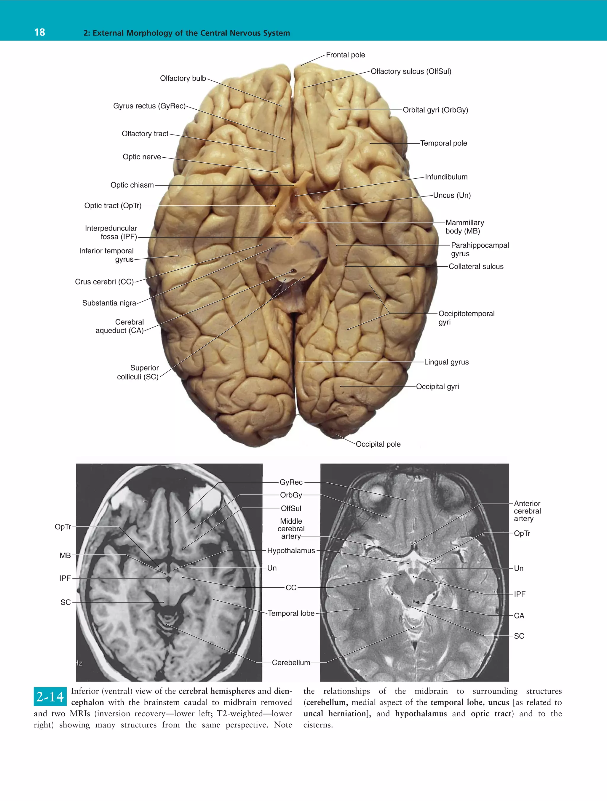 Neuroanatomy in Clinical Context -1 Duane E. Haines (9th Edition).pdf