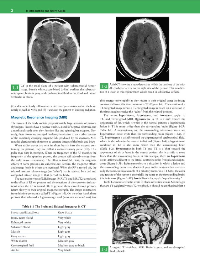 Neuroanatomy in Clinical Context -1 Duane E. Haines (9th Edition).pdf ...