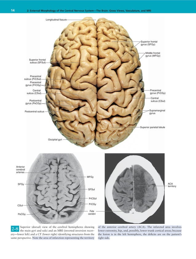Neuroanatomy in Clinical Context -1 Duane E. Haines (9th Edition).pdf ...