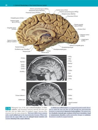 Neuroanatomy in Clinical Context -1 Duane E. Haines (9th Edition).pdf