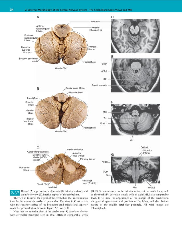 Neuroanatomy in Clinical Context -1 Duane E. Haines (9th Edition).pdf ...