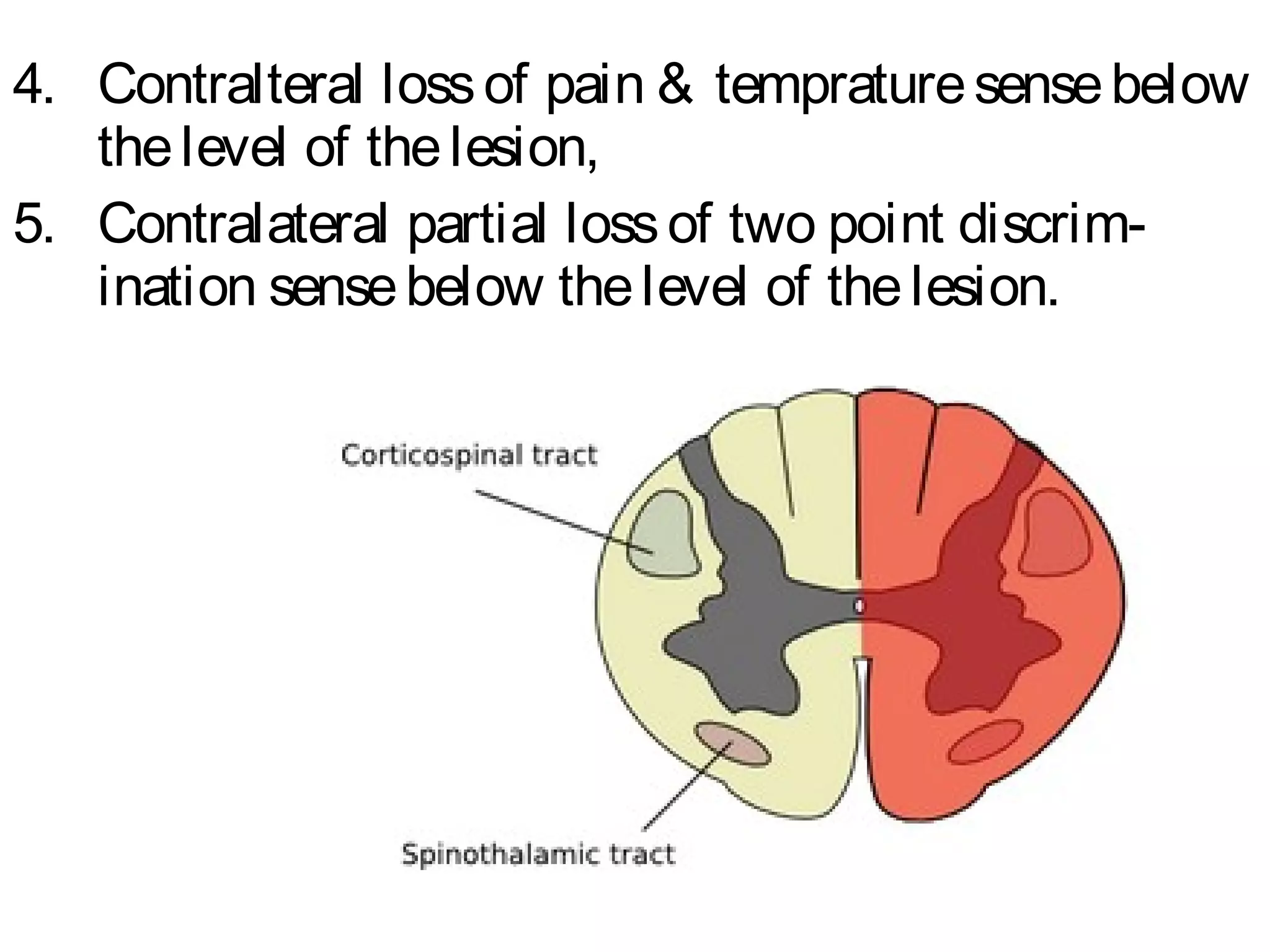 Ascending & Descending Tracts Of The Spinal Cord | PPT