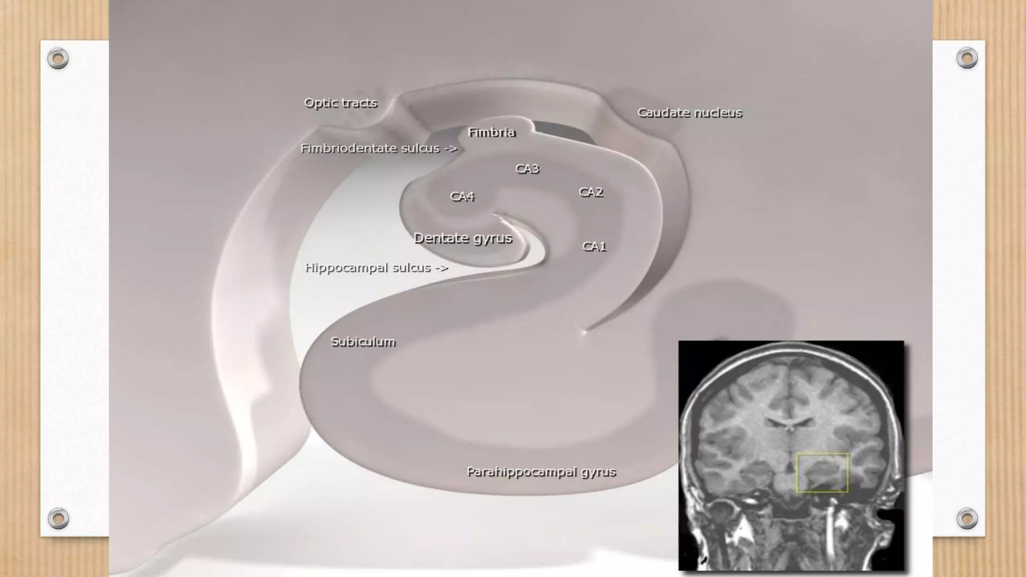 Neuroanatomy of limbic system | PPTX