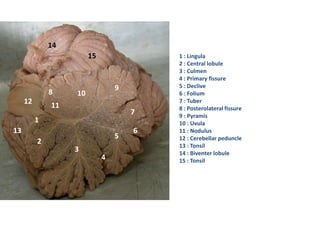 Neuroanatomy reviewer Cerebrum, Cerebellum, Pons | PPTX