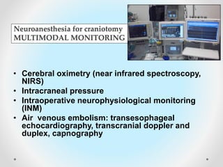 Neuroanesthesiology at hospital universitario central de asturias ( | PPT