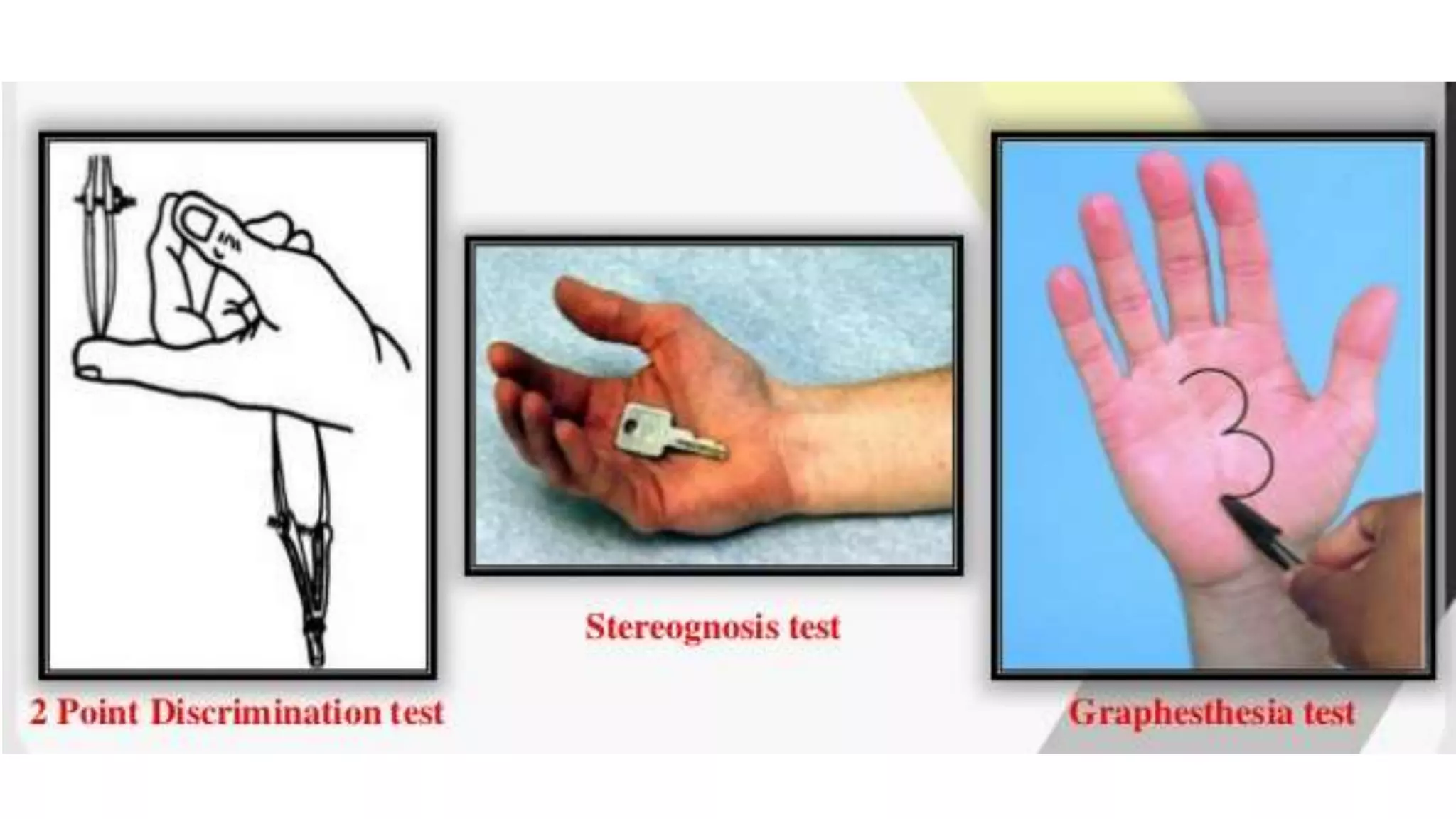 Neurological assessment | PPTX