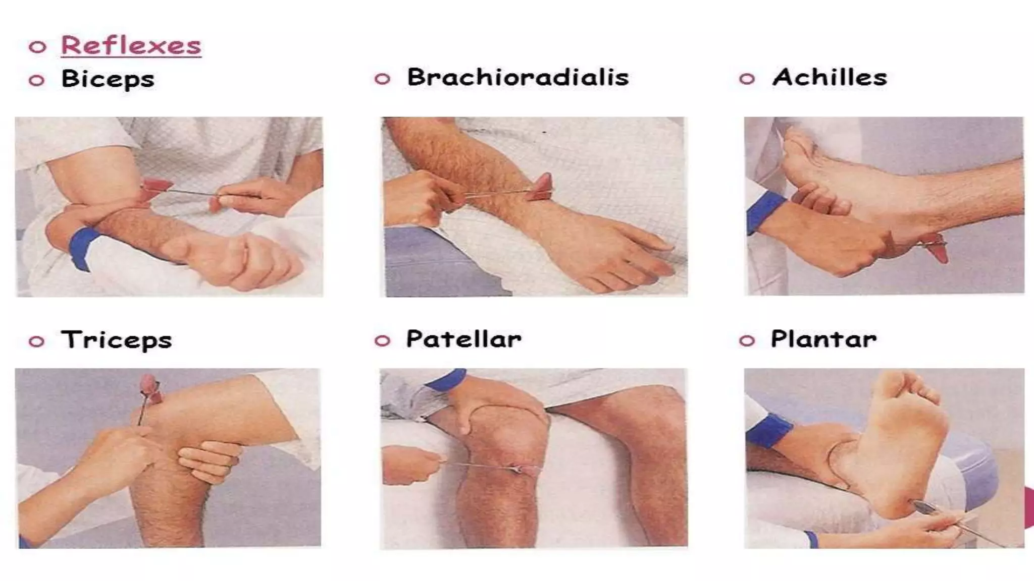 Neurological assessment | PPTX
