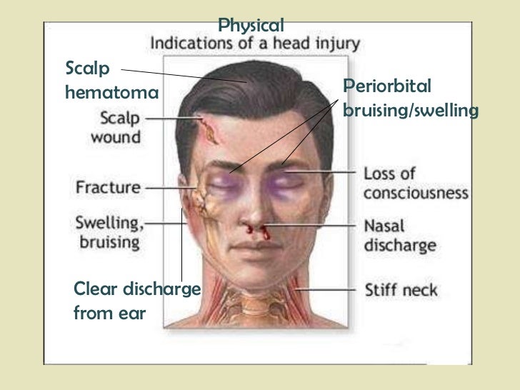 Icd 9 Code For Seborrheic Area Of Ear icd-9-code-for-seborrheic-area-of-ear