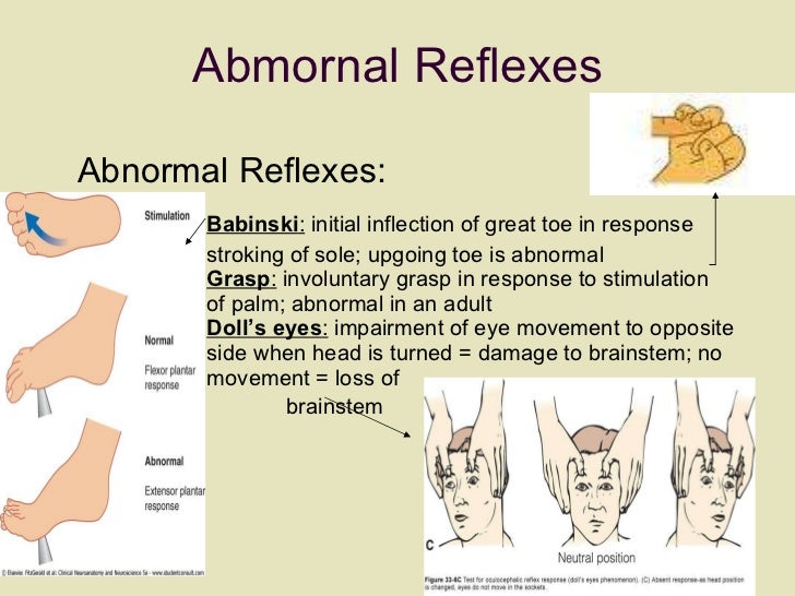 Neuro assessment hdsp final 10.09