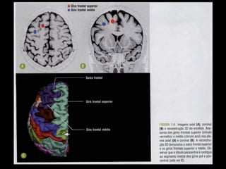 Neurorradiologia anatomia e AVCI | PDF