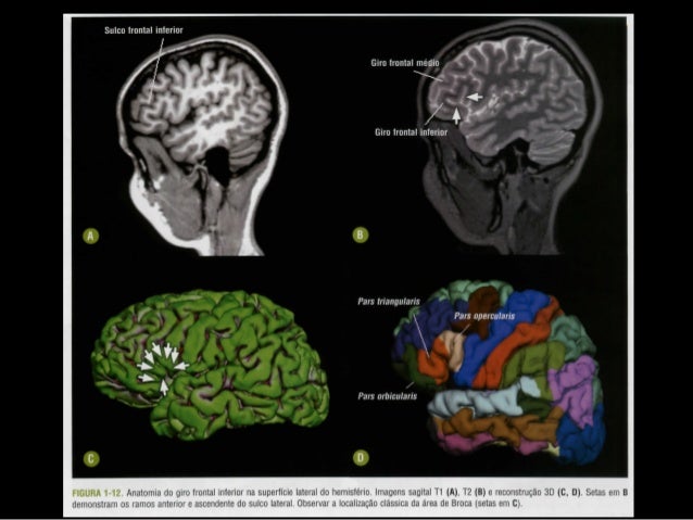 Neurorradiologia anatomia e AVCI