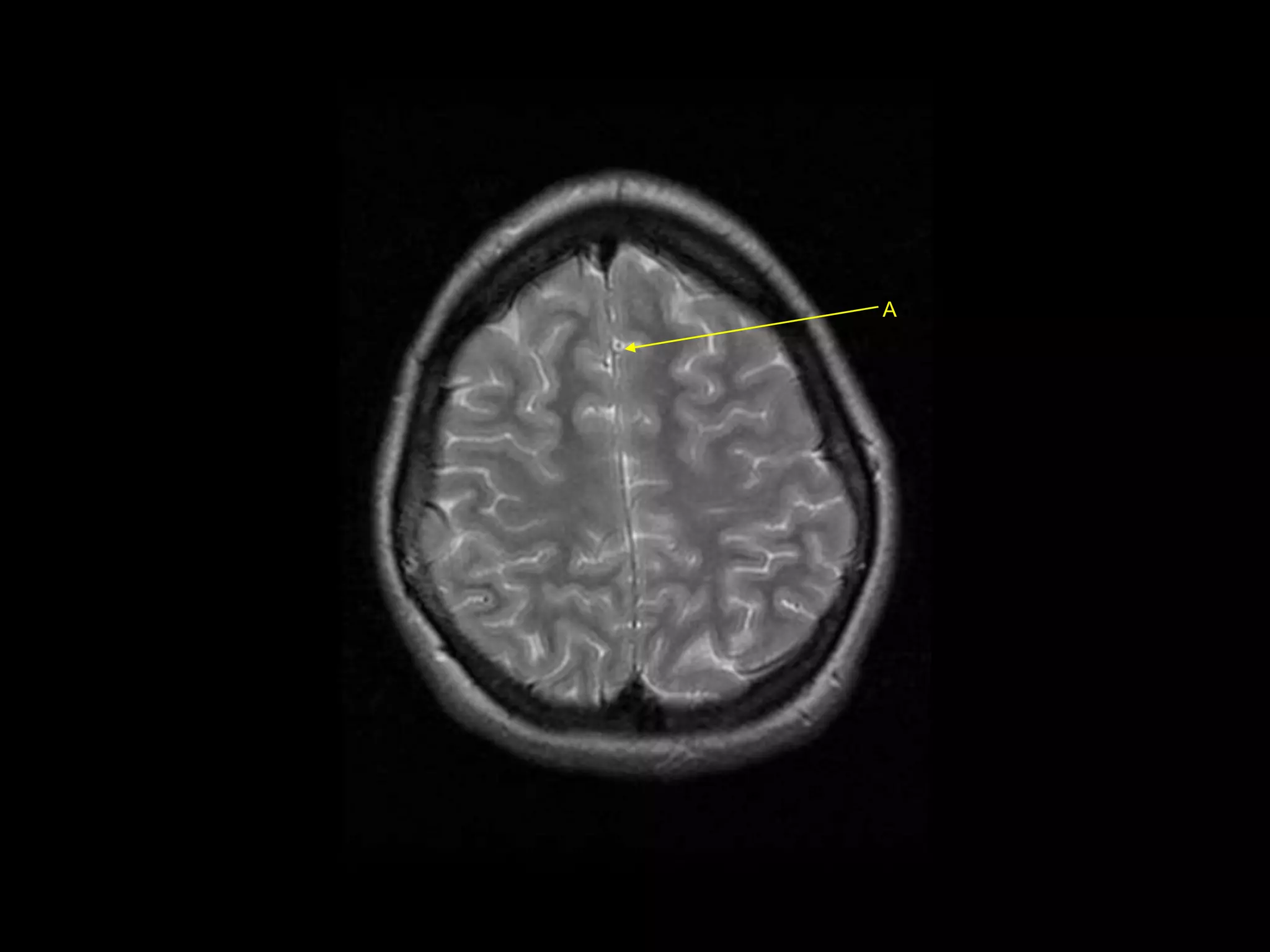 MRI BRAIN AXIAL IMAGE WITH LABELING | PPT