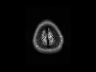 MRI BRAIN AXIAL IMAGE WITH LABELING | PPT