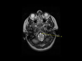 MRI BRAIN AXIAL IMAGE WITH LABELING | PPT