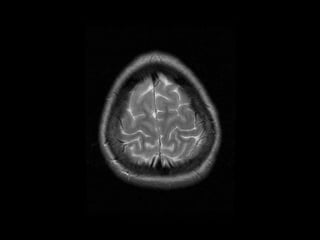 MRI BRAIN AXIAL IMAGE WITH LABELING | PPT