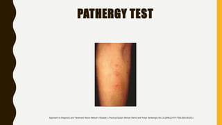 Neuro Behcet’s | PPTX