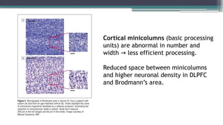 NEUROBIOLOGY OF AUTISM SPECTRUM DISORDER | PPTX
