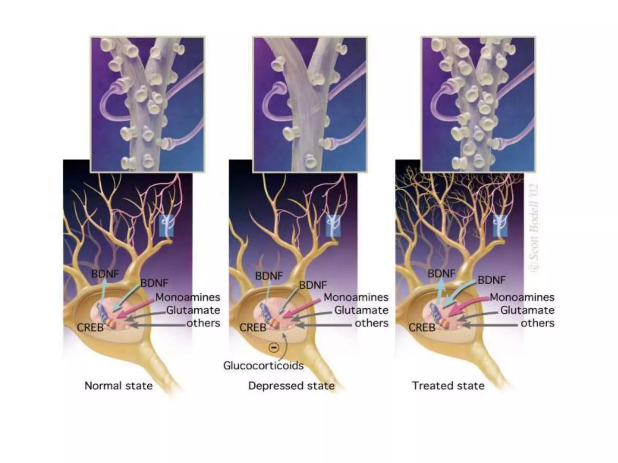 Neurobiology And Functional Brain Circuits In Mood Disorders Pptx Brain And Nervous System