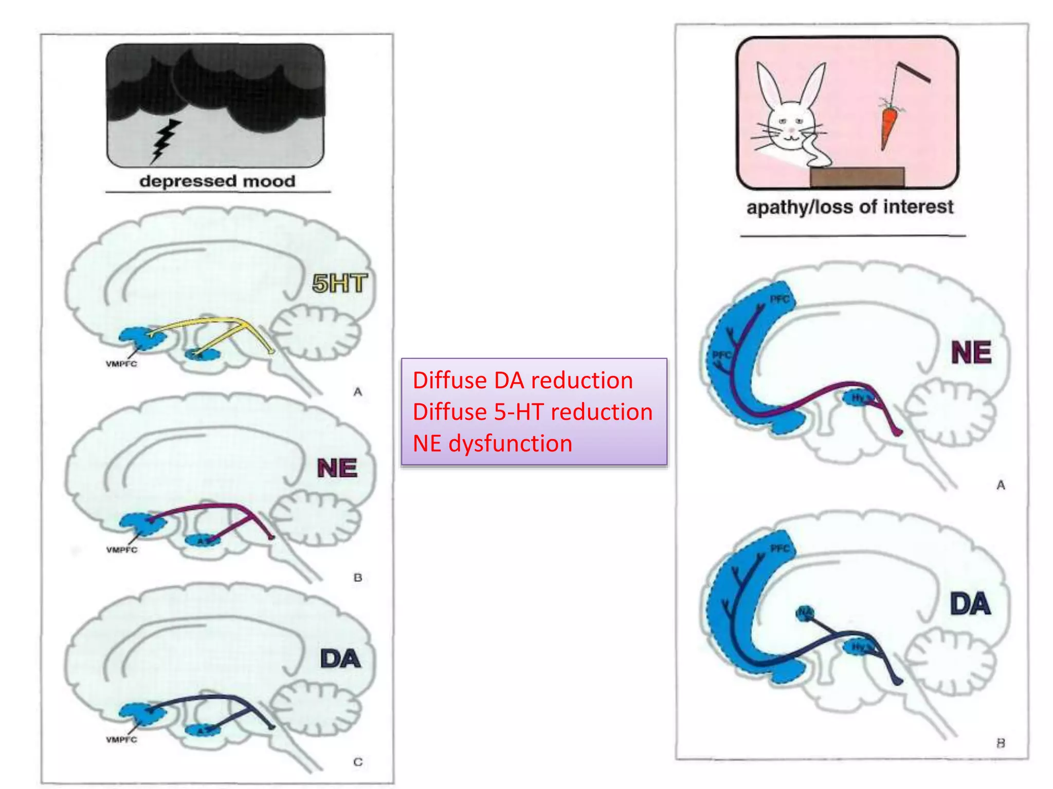 Neurobiology And Functional Brain Circuits In Mood Disorders Pptx Brain And Nervous System