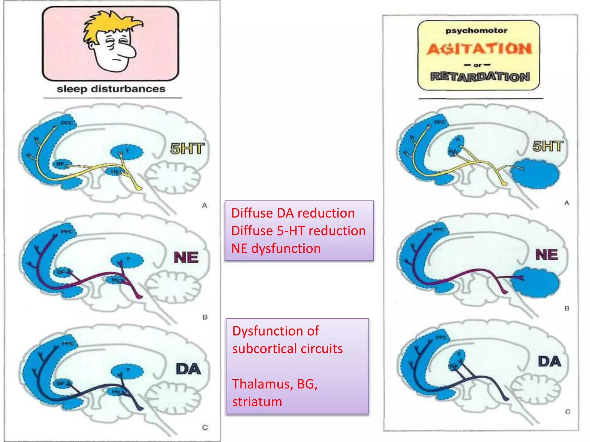 Neurobiology And Functional Brain Circuits In Mood Disorders Pptx Brain And Nervous System