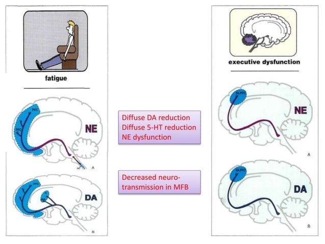 Neurobiology And Functional Brain Circuits In Mood Disorders Pptx Brain And Nervous System