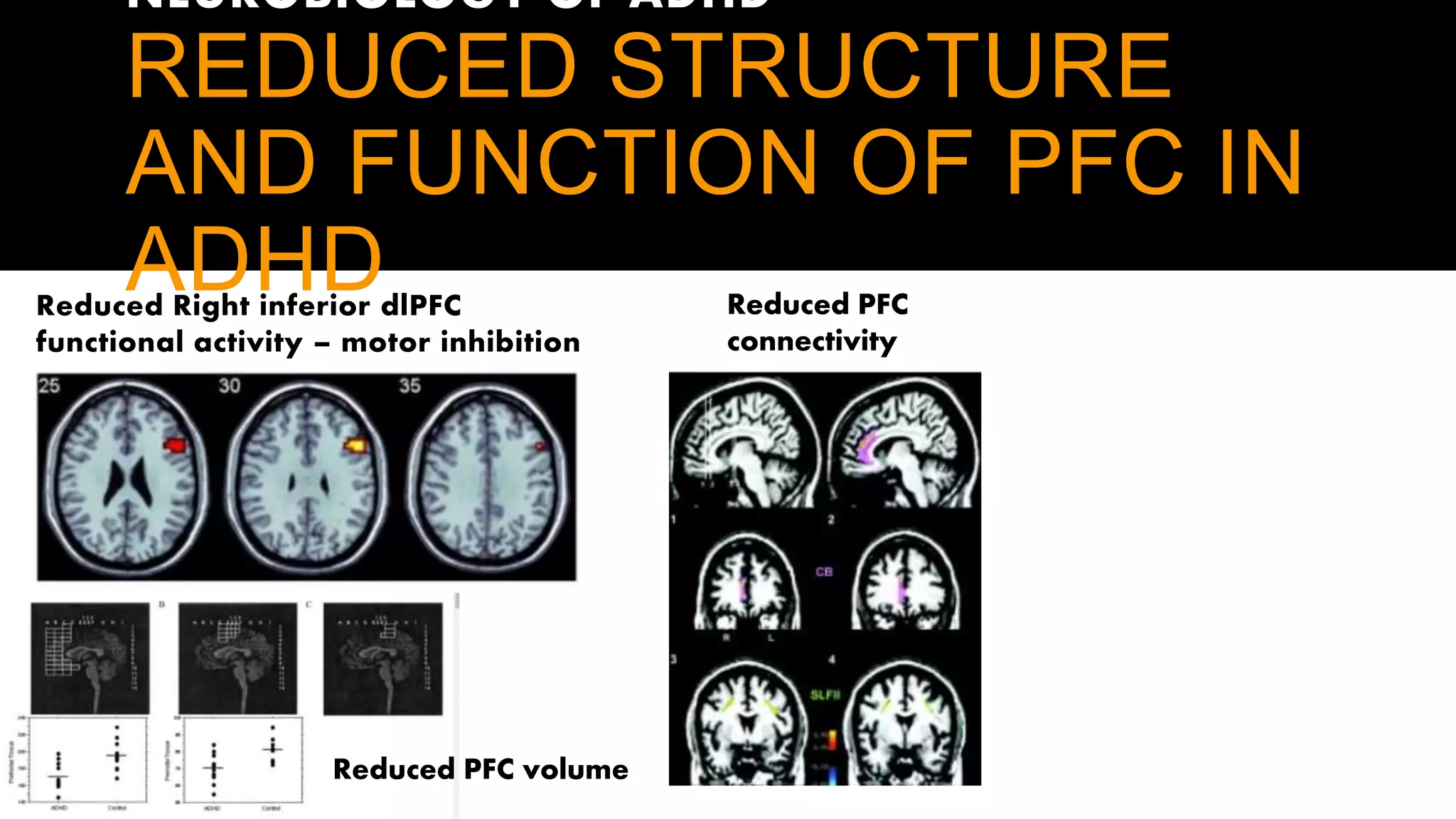 Neurobiology of attention deficit hyperactivity disorder | PPTX