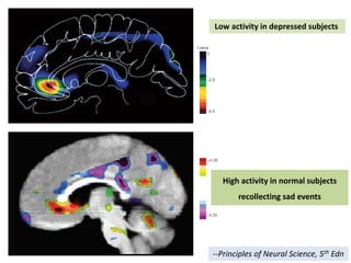 Sociopath Brain Scan Graph