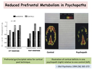 Sociopath Brain Scan Graph
