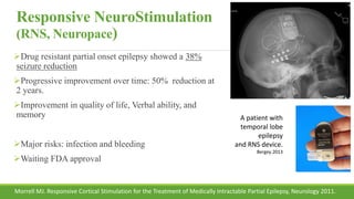 Neurobionics and robotic neurorehabilitations | PPTX