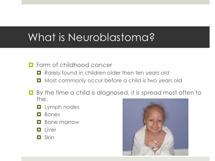 Neuroblastoma