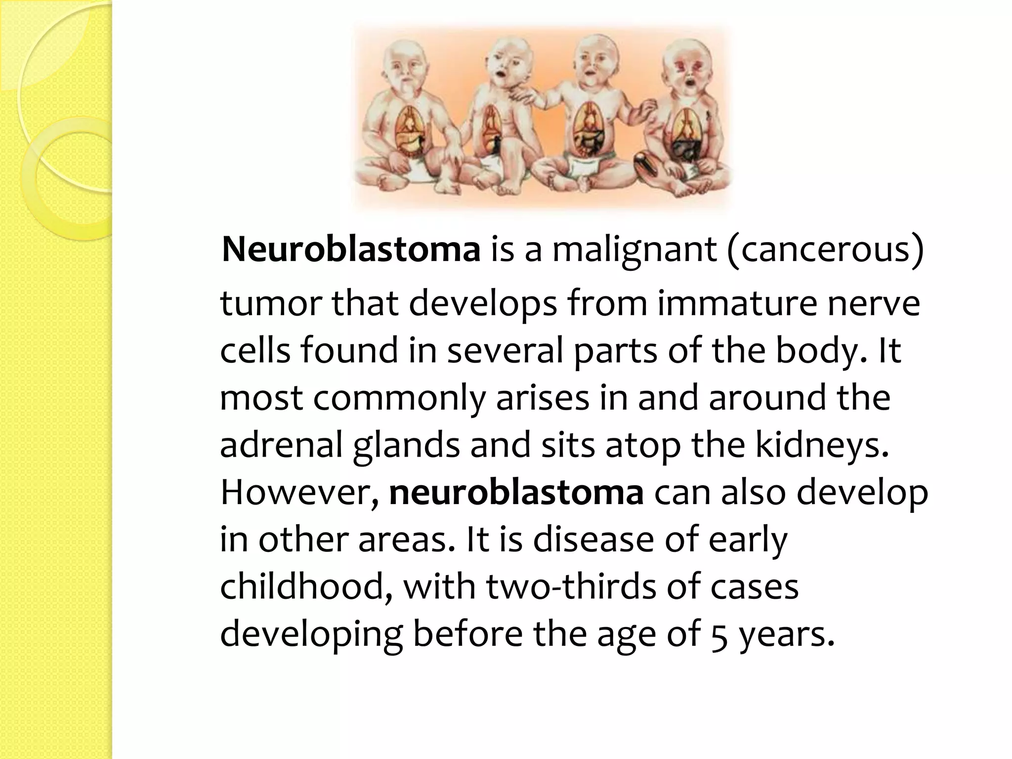 Neuroblastoma | PPTX