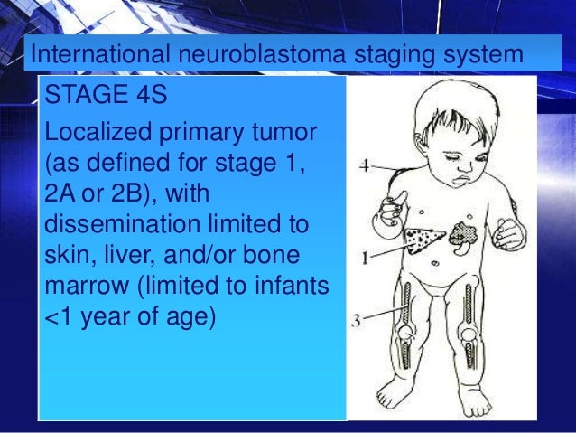 Neuroblastoma