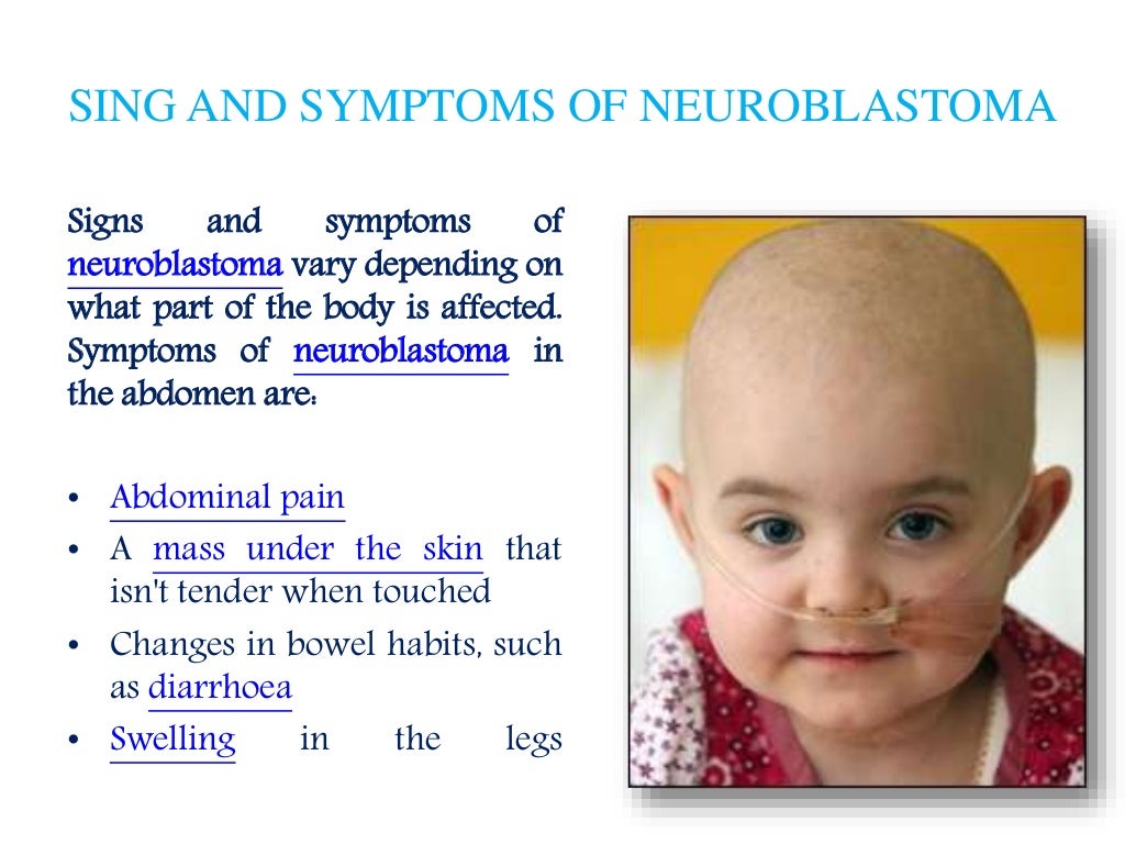Neuroblastoma: Patient info on symptoms, diagnosis and treatment opti…