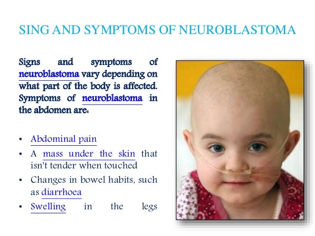 Neuroblastoma: Patient info on symptoms, diagnosis and treatment opti…