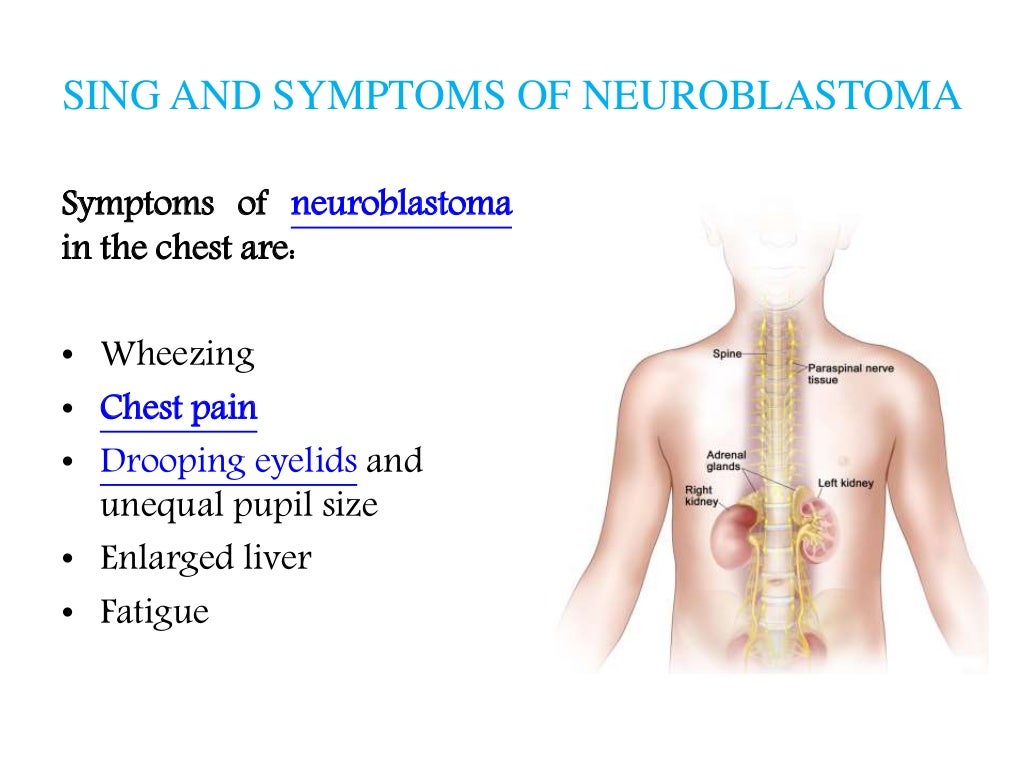 Neuroblastoma: Patient info on symptoms, diagnosis and treatment options