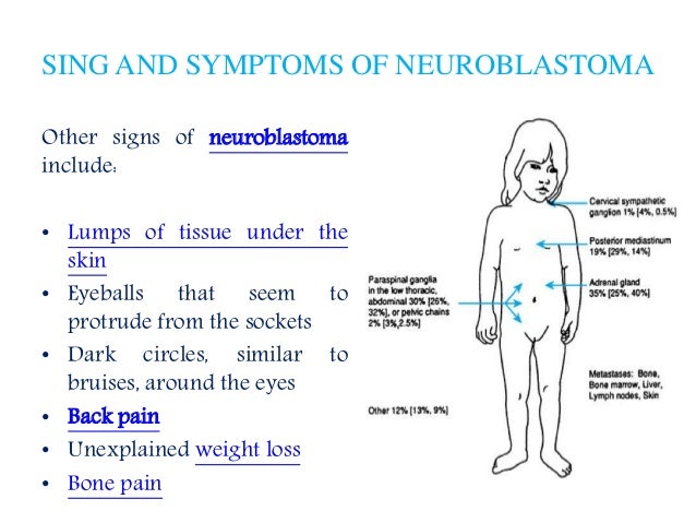 Neuroblastoma: Patient info on symptoms, diagnosis and treatment opti…