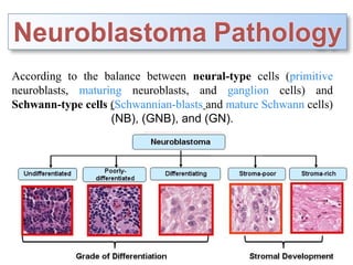 Neuroblastoma presentation | PPT
