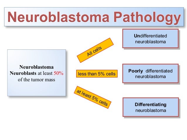 Neuroblastoma presentation