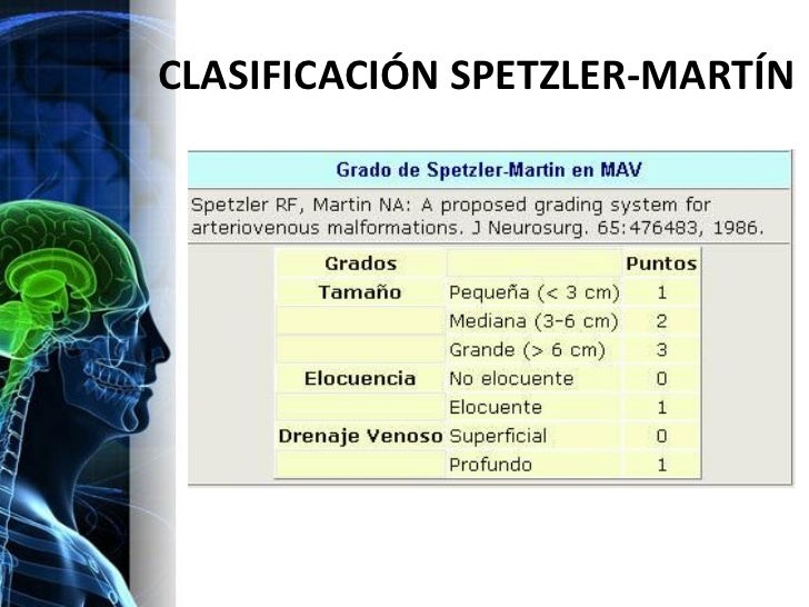 Neurocirugía mav