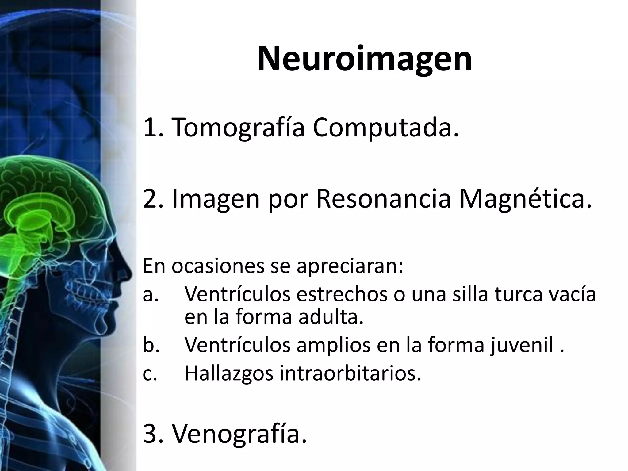 Neurocirugia pseudotumor cerebral | PPT