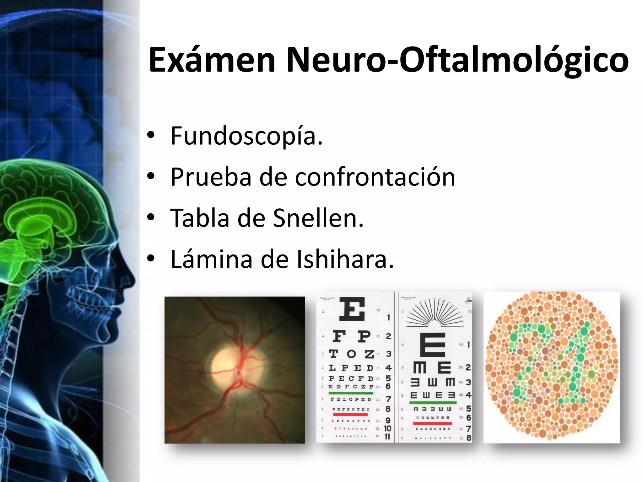 Neurocirugia pseudotumor cerebral | PPT